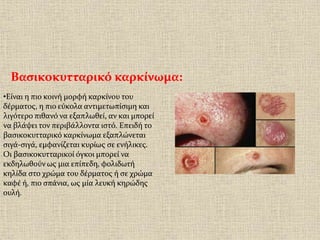 α1 εργασια για τον ηλιο | PPTX