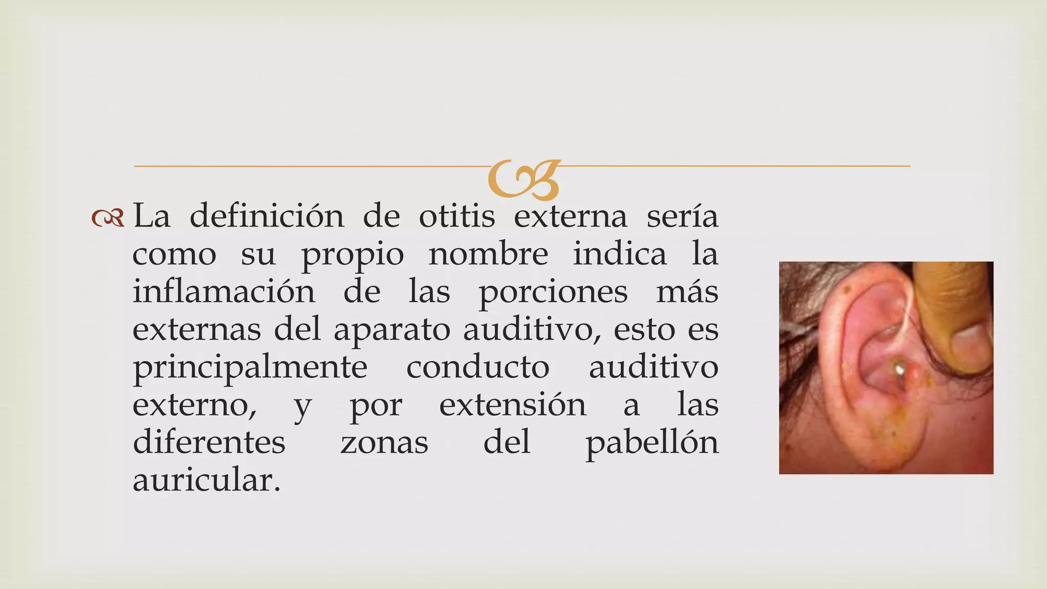 1.6.1 otitis externa,media e interna | PPTX | Ear, Nose and Throat ...