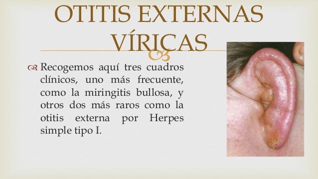 1.6.1 otitis externa,media e interna