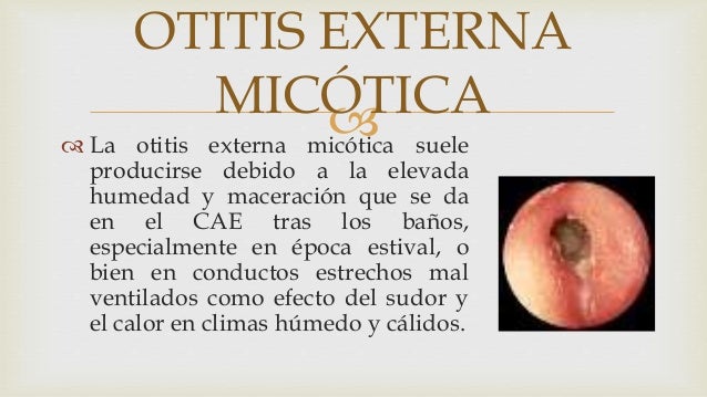 1.6.1 otitis externa,media e interna