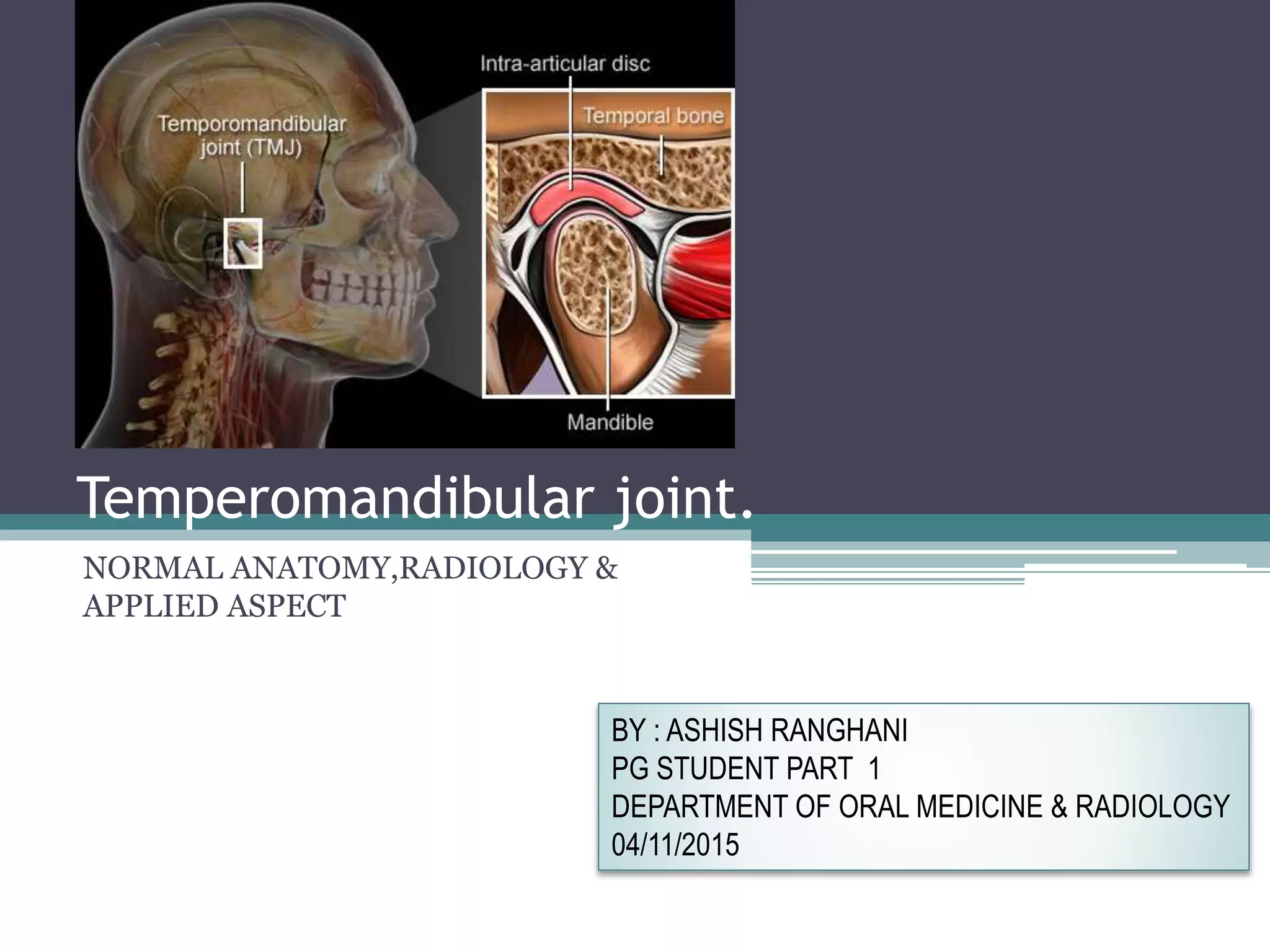 Temperomandibular joint Anatomy | PPTX