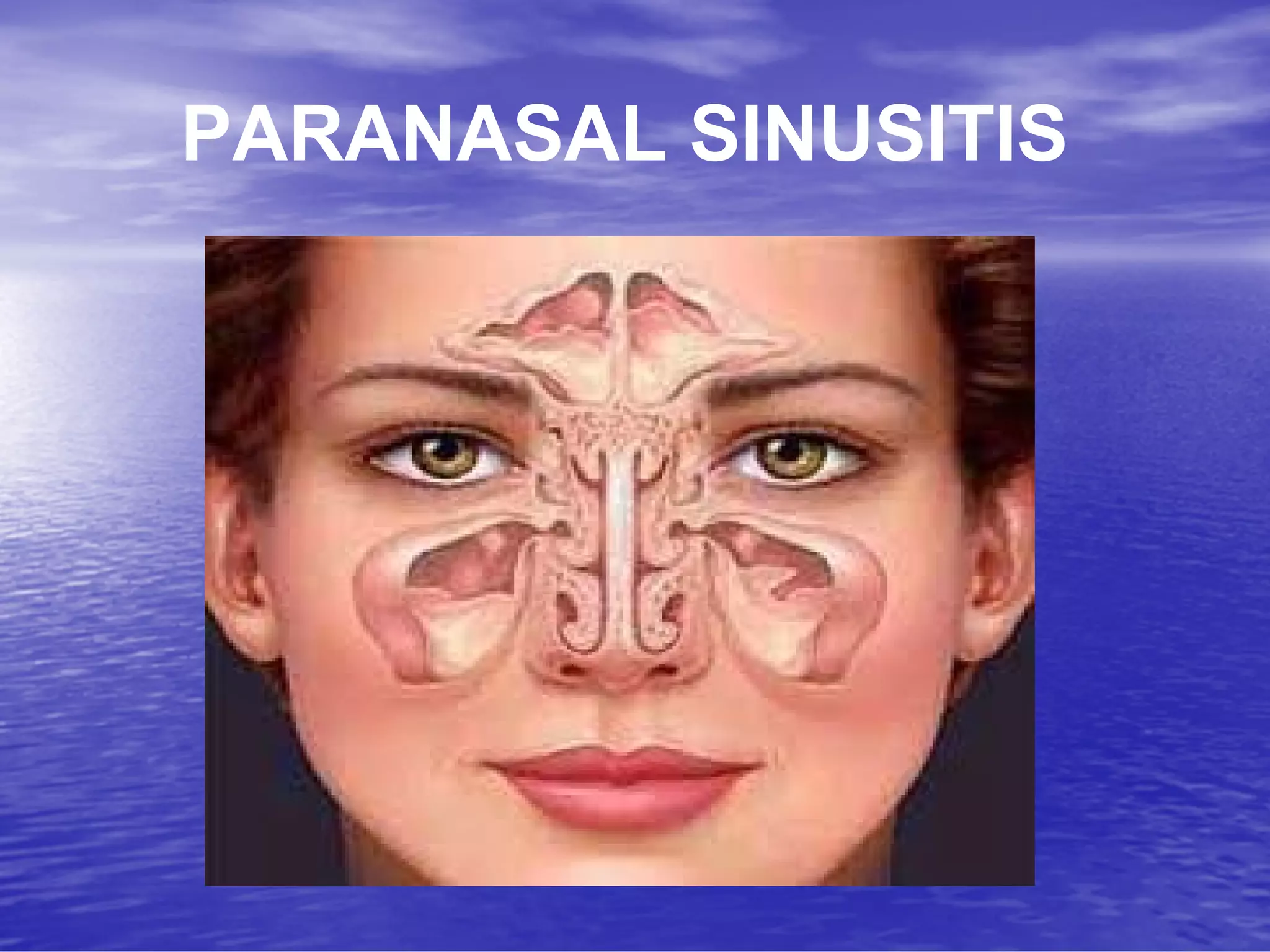 Anatomy, Physiology & Diseases of nose. Paranasal sinuses | PPT