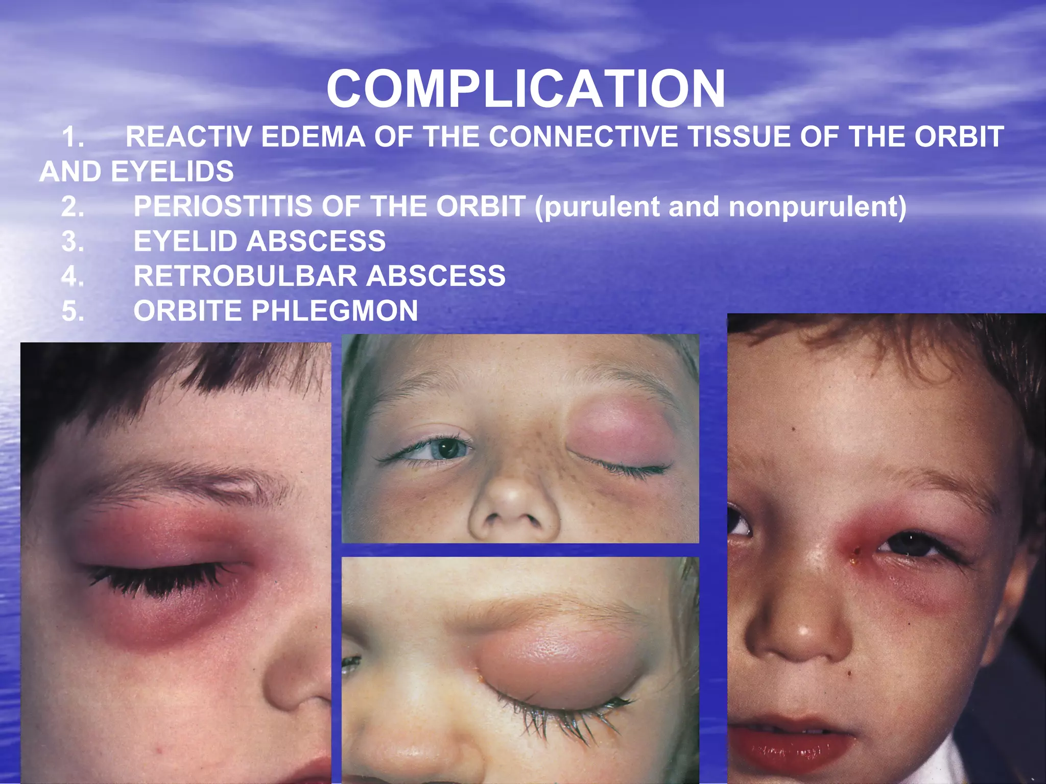 Anatomy, Physiology & Diseases of nose. Paranasal sinuses | PPT
