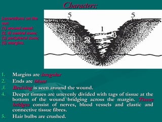 Bases of Forensic medical traumatology. Blunt objects | PPT