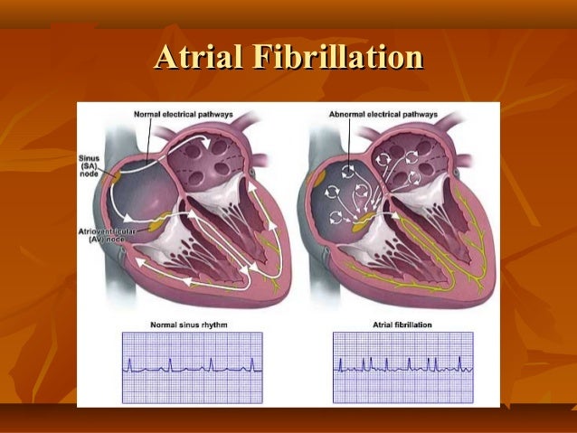 Rhythms of the Heart
