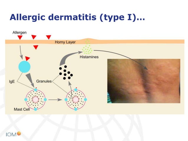 Why is dermal exposure important? | PPT