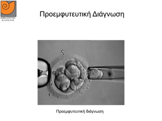 Ζητήματα Βιοηθικής: Προγεννετική και Προεμφυτευτική διάγνωση | PDF