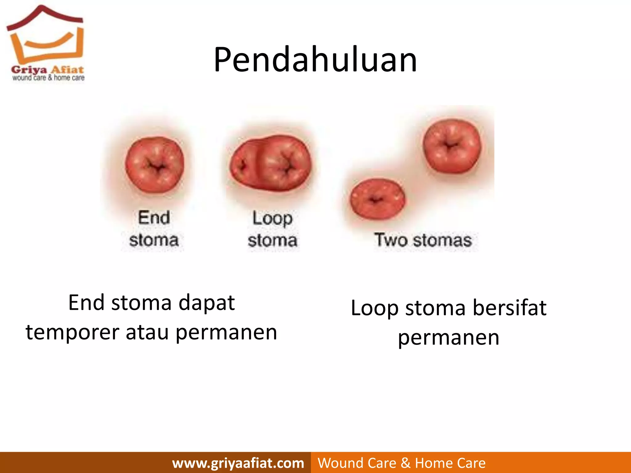 1. konsep dasar stoma | PPTX