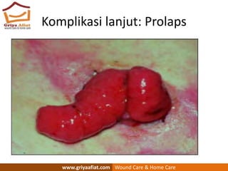 1. konsep dasar stoma | PPTX