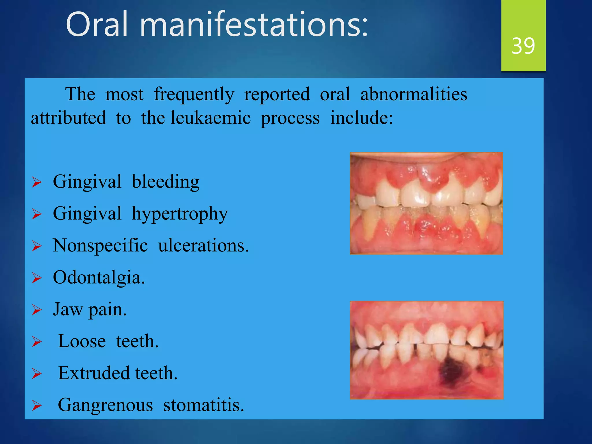 LEUKAEMIA, DENTAL APPLICATIONS | PPTX