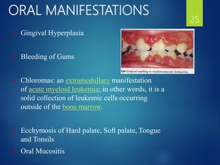 Leukemia Oral Symptoms