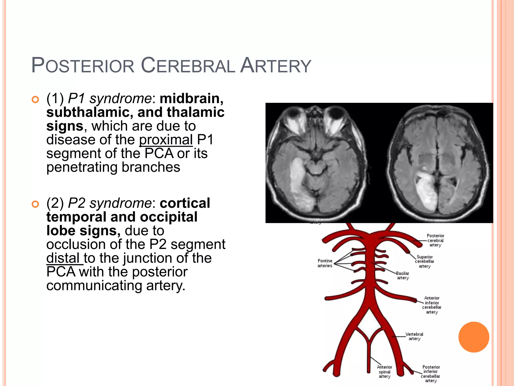 1.stroke epidemiology and stroke syndromes dr trilochan shrivastava | PPTX