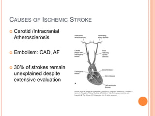 1.stroke epidemiology and stroke syndromes dr trilochan shrivastava | PPTX
