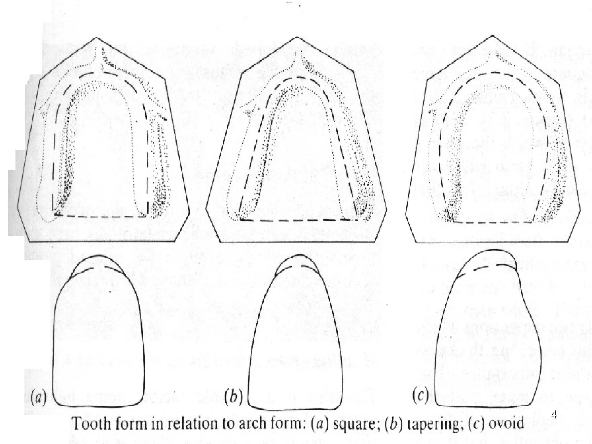 Artificial Teeth Arrangement | PPT