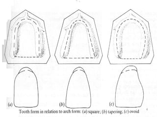 Artificial Teeth Arrangement | PPT