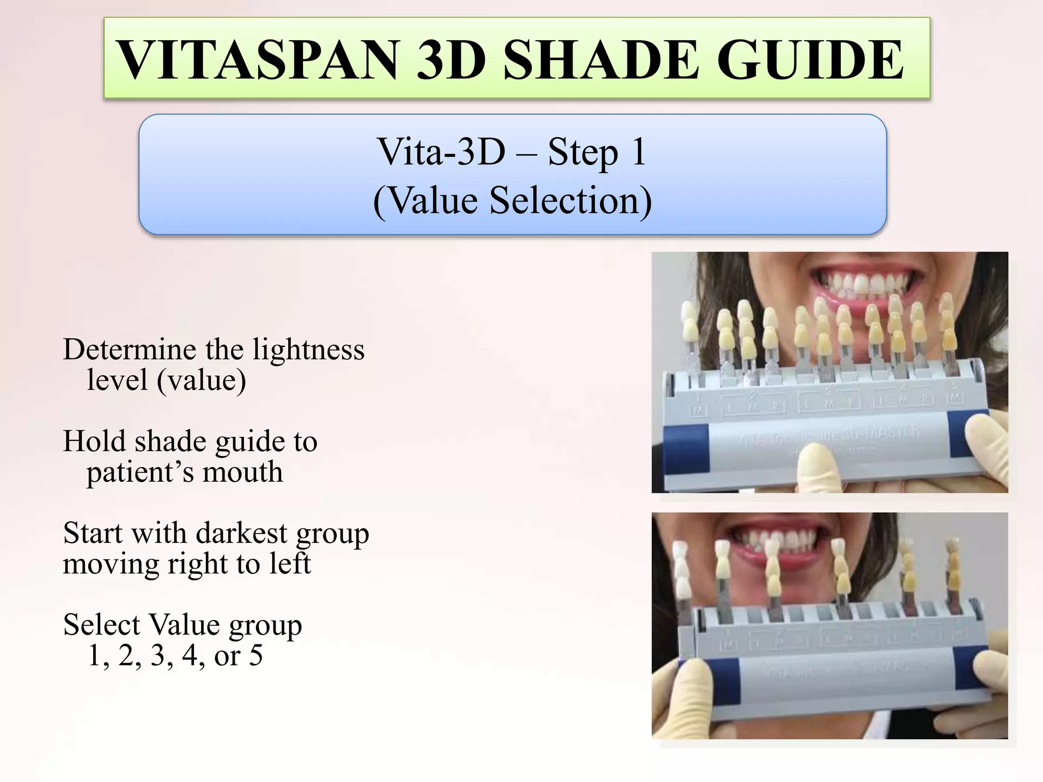 Shade selection | PPTX