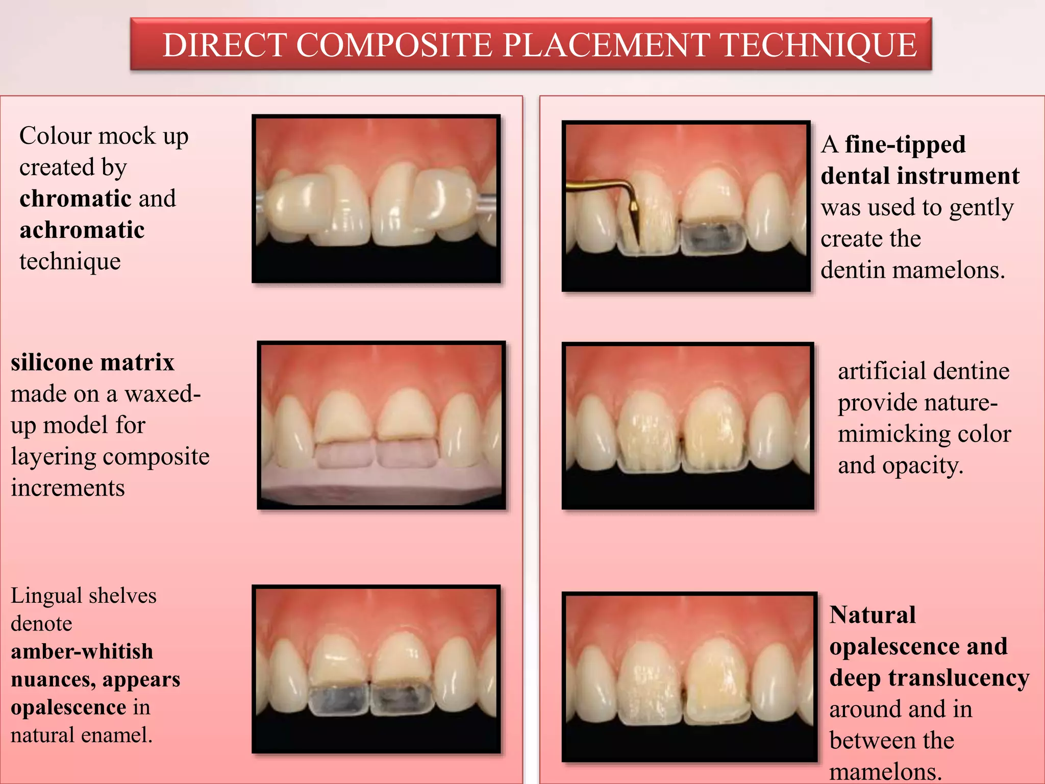 Shade selection | PPTX