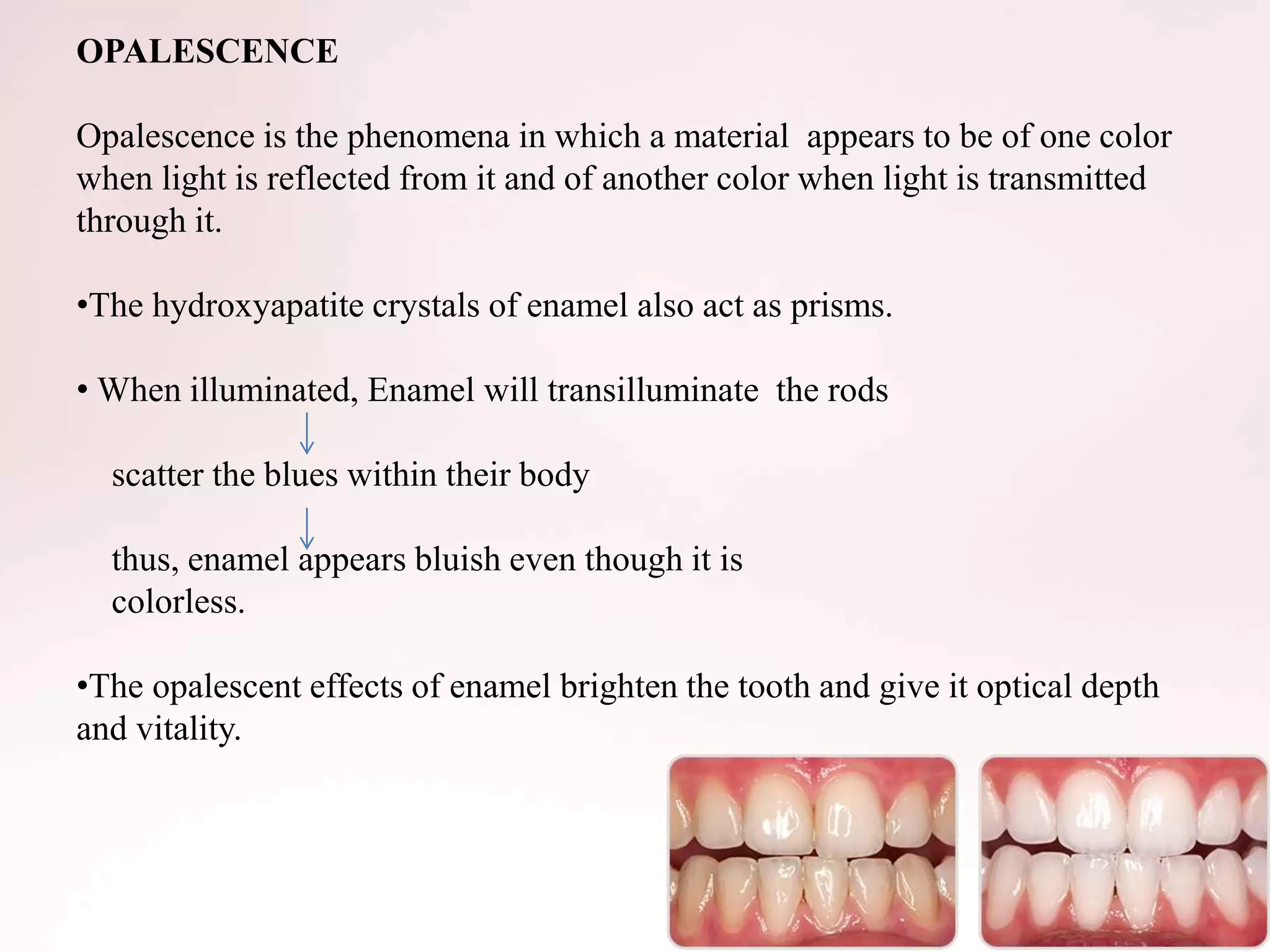 Shade selection | PPTX