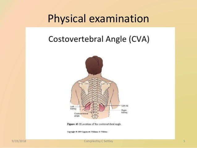 Ued Pescara Costovertebral Angle