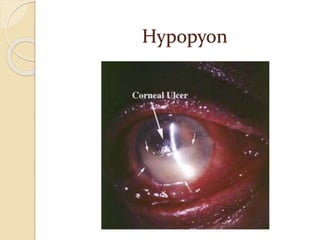 1.anatomy , physiology , pathology of cornea | PPT