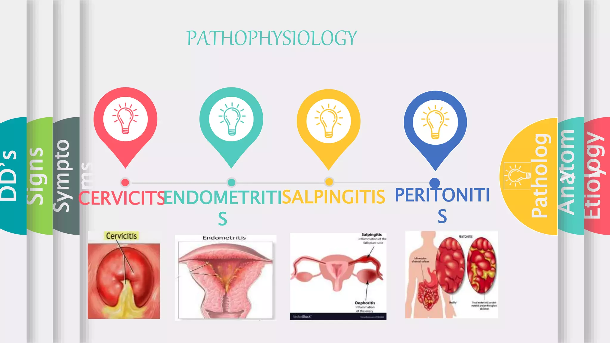 Pelvic Inflammatory Disease | PPTX