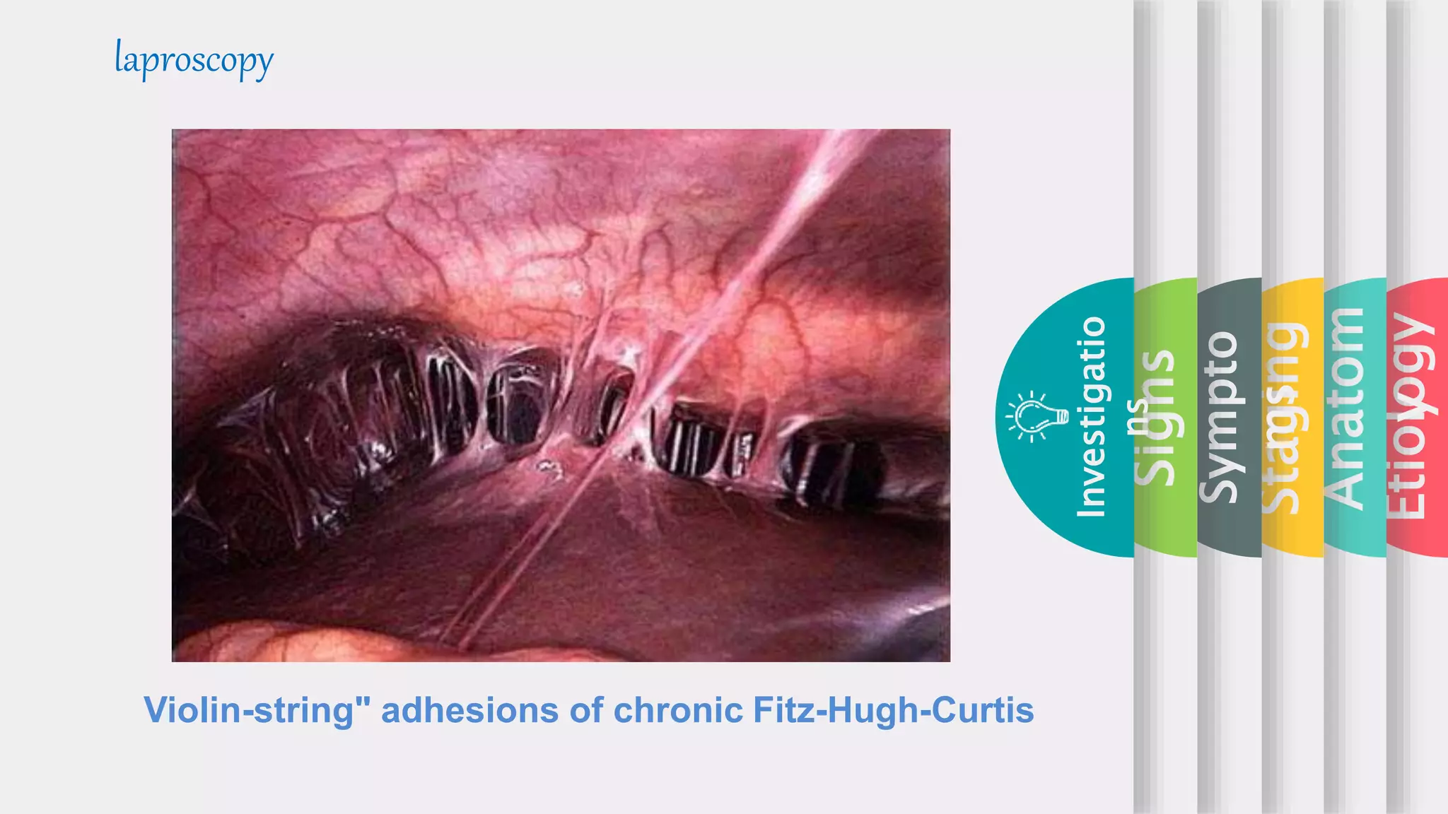 Pelvic Inflammatory Disease | PPTX