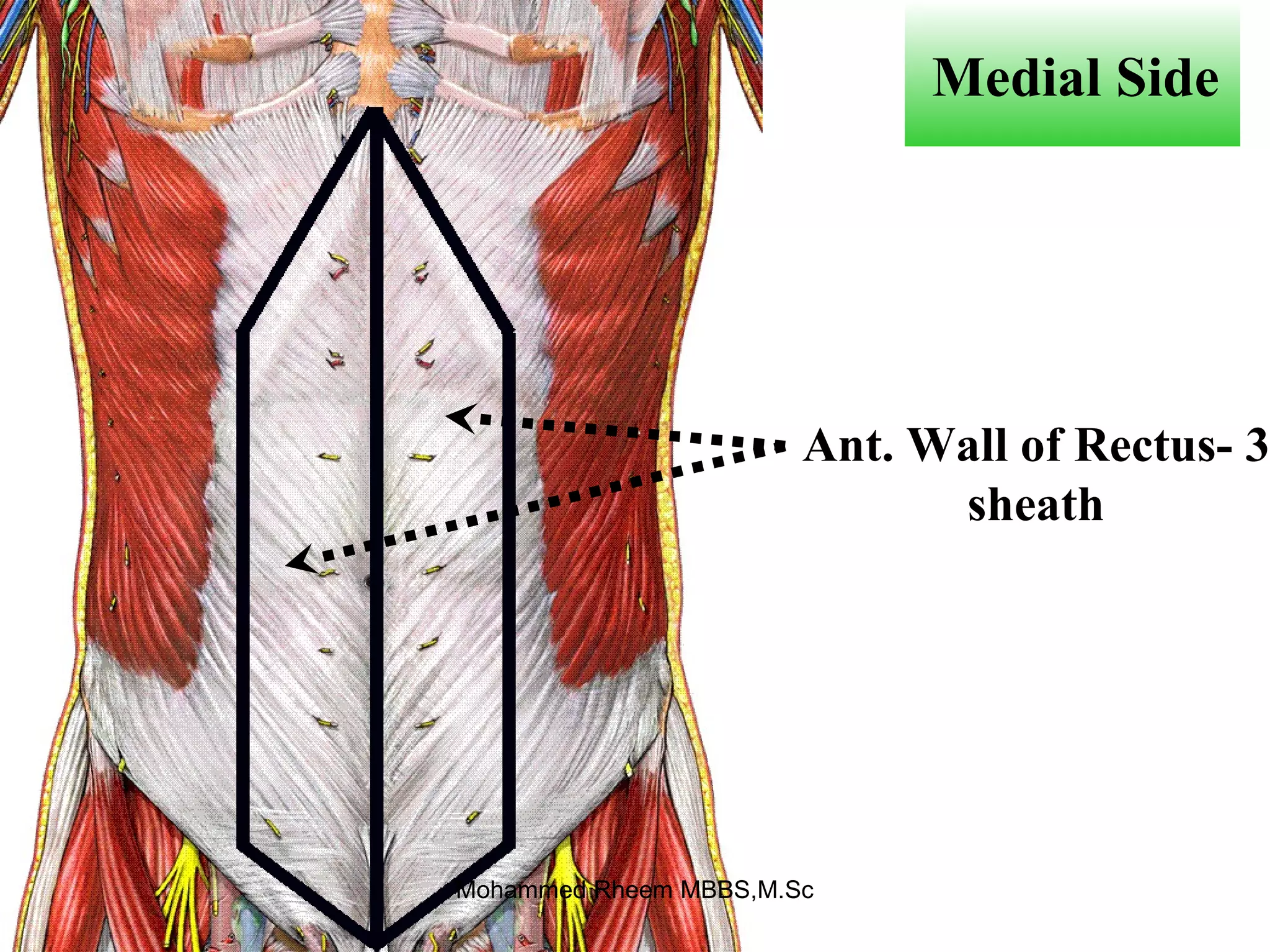 anterior abdominal wall | PPT