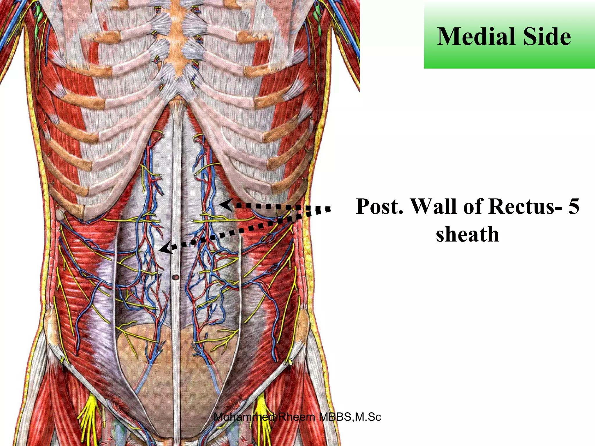 anterior abdominal wall | PPT