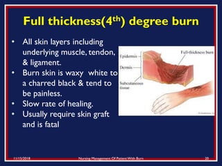 4th Degree Burn Diagram