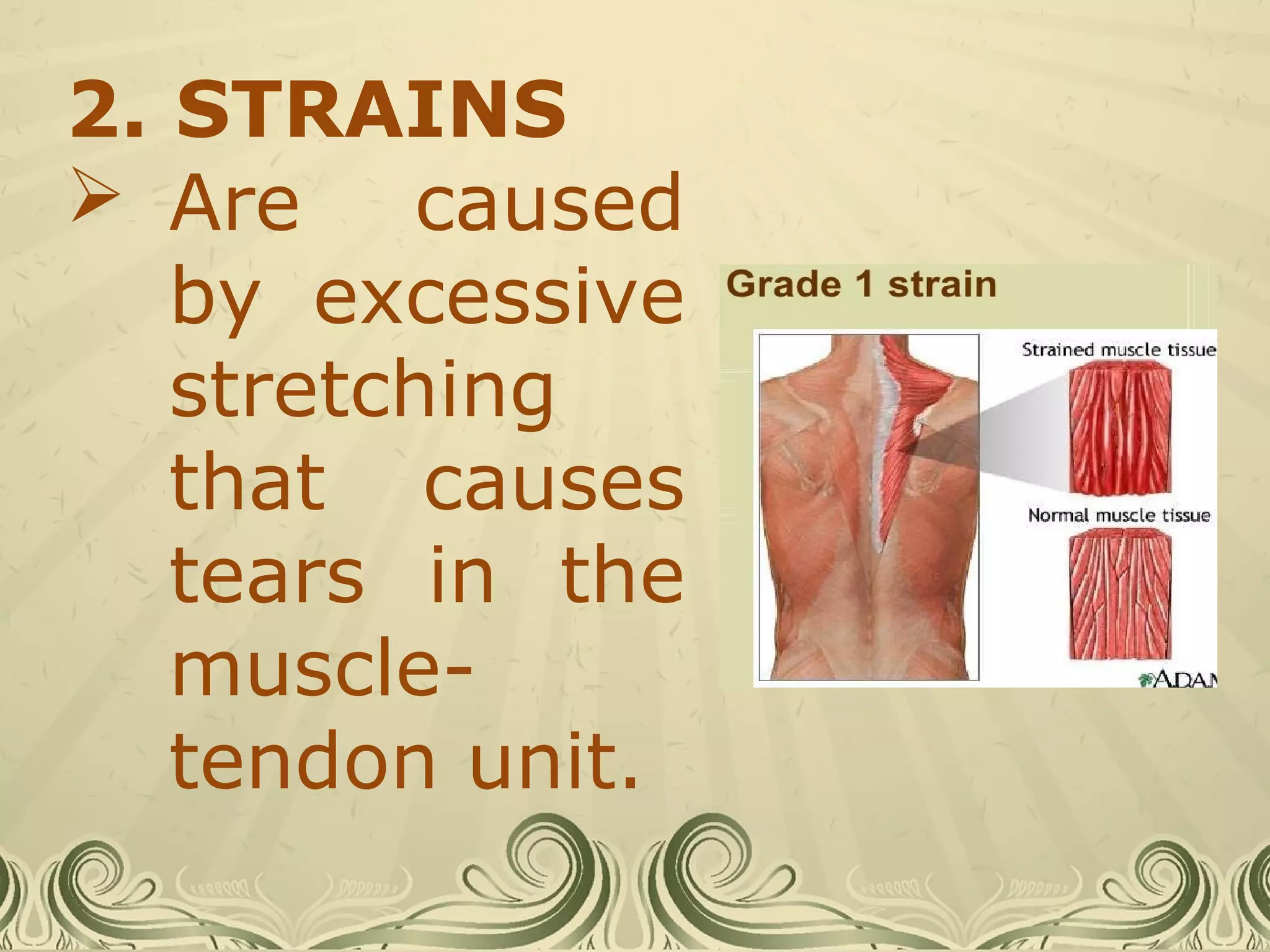 Sports Injuries (Grade 11 PE and HEALTH) | PPT