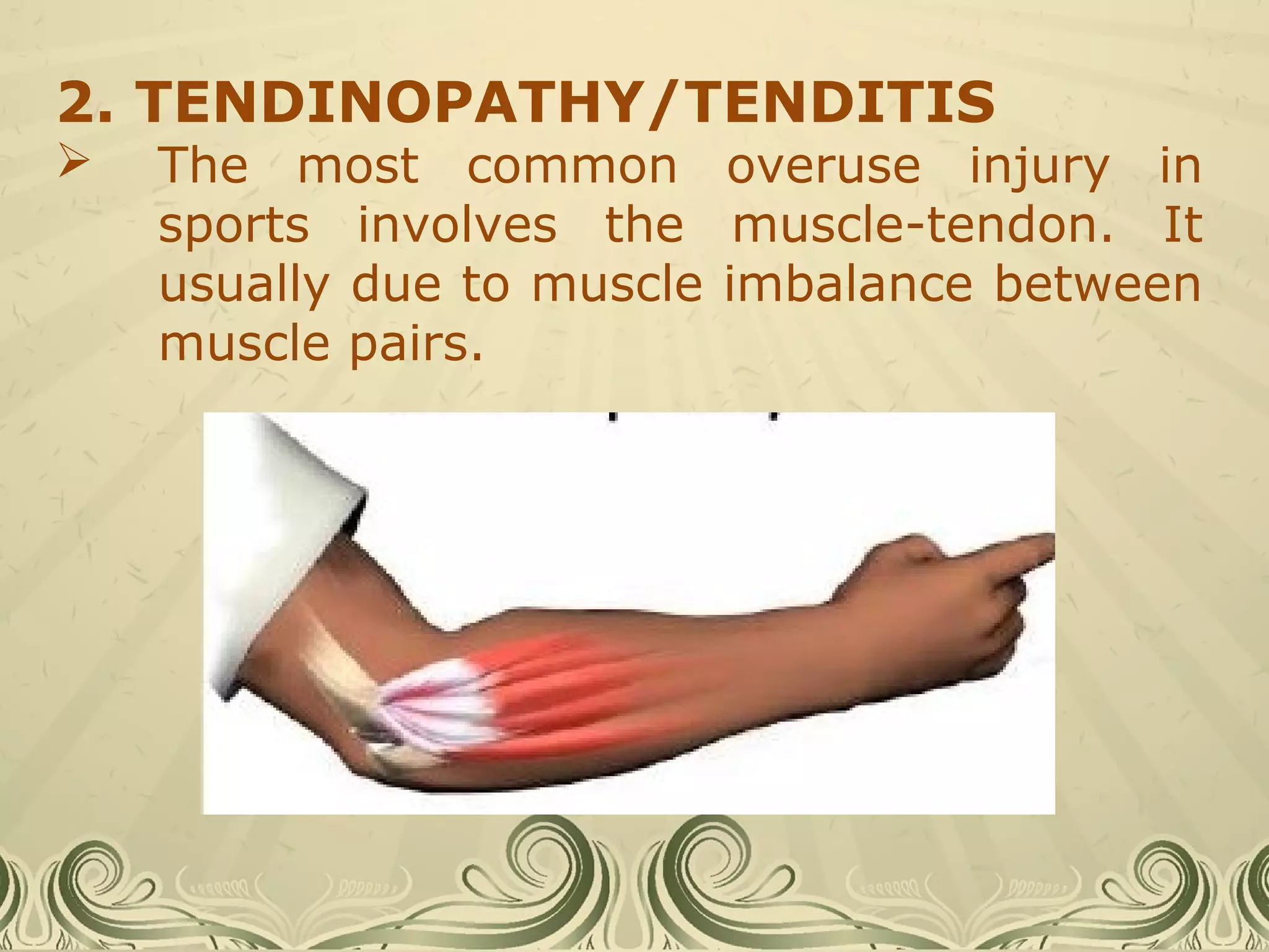 Sports Injuries (Grade 11 PE and HEALTH) | PPT