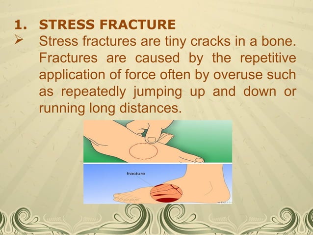 Sports Injuries (Grade 11 PE and HEALTH) | PPT