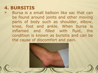 Sports Injuries (Grade 11 PE and HEALTH) | PPT