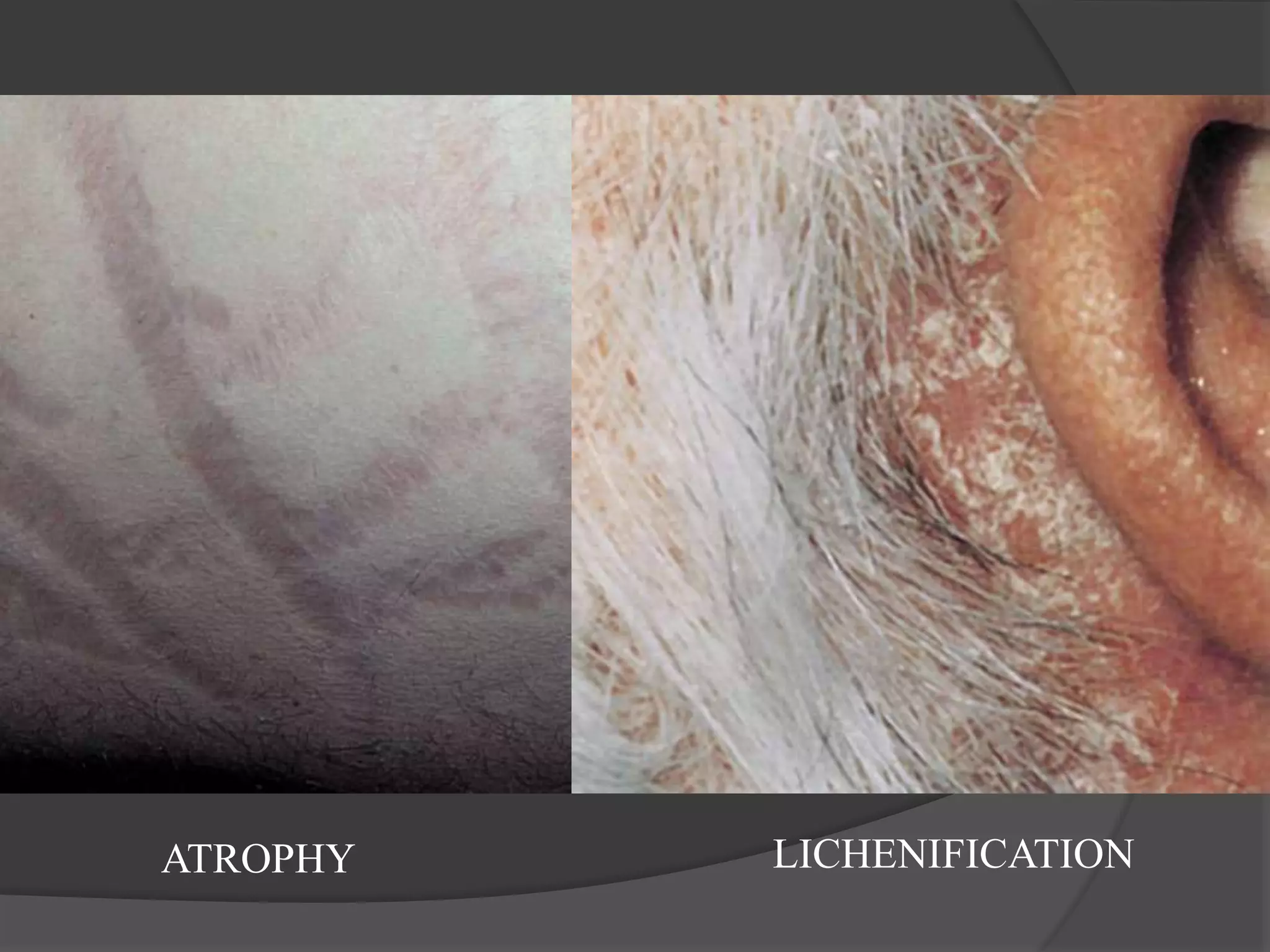 1. Basic structures and functions of skin | PPTX