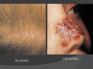 1. Basic structures and functions of skin | PPTX