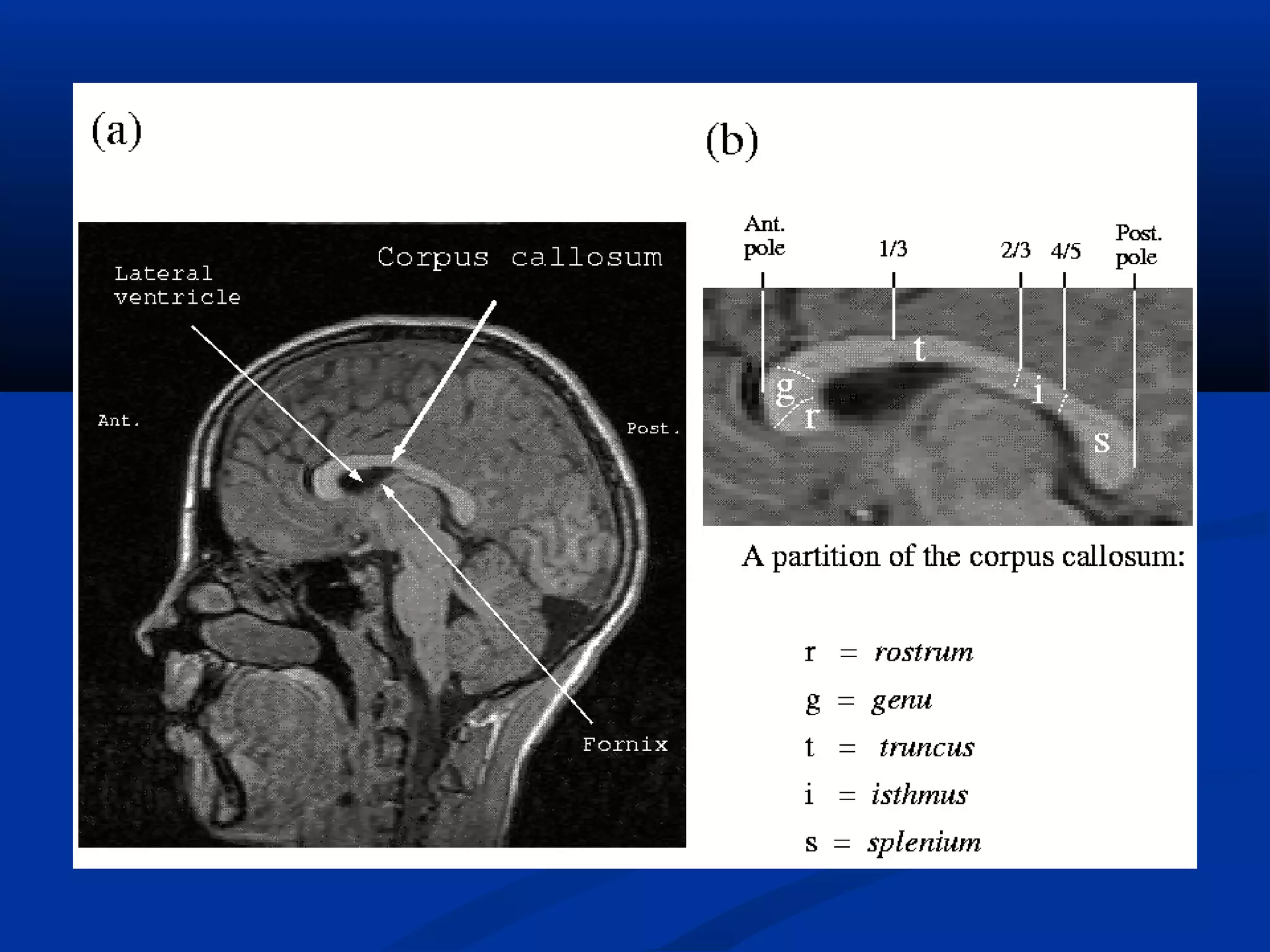 Radiological anatomy of the brain | PPT
