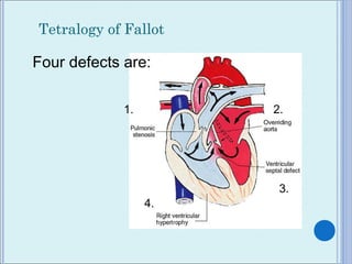 Congenital cyanotic Heart Disease -Dr.Wahid Helmi ., Pediatric ...