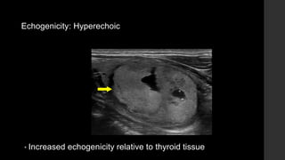 thyroid imaging reporting & data system | PPTX