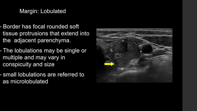 thyroid imaging reporting & data system | PPTX