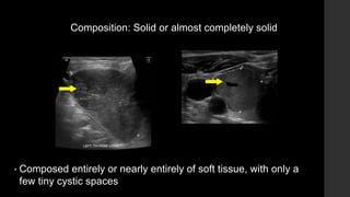 thyroid imaging reporting & data system | PPTX
