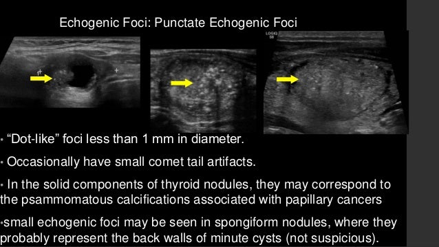thyroid imaging reporting & data system