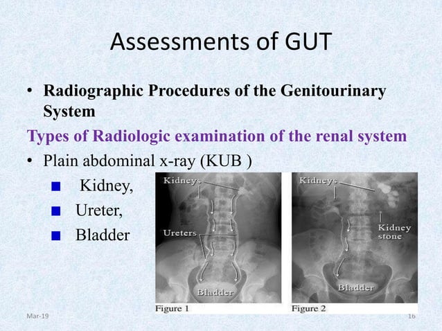 genito urinary disorders medical surgical ii | PPTX | Medical Health