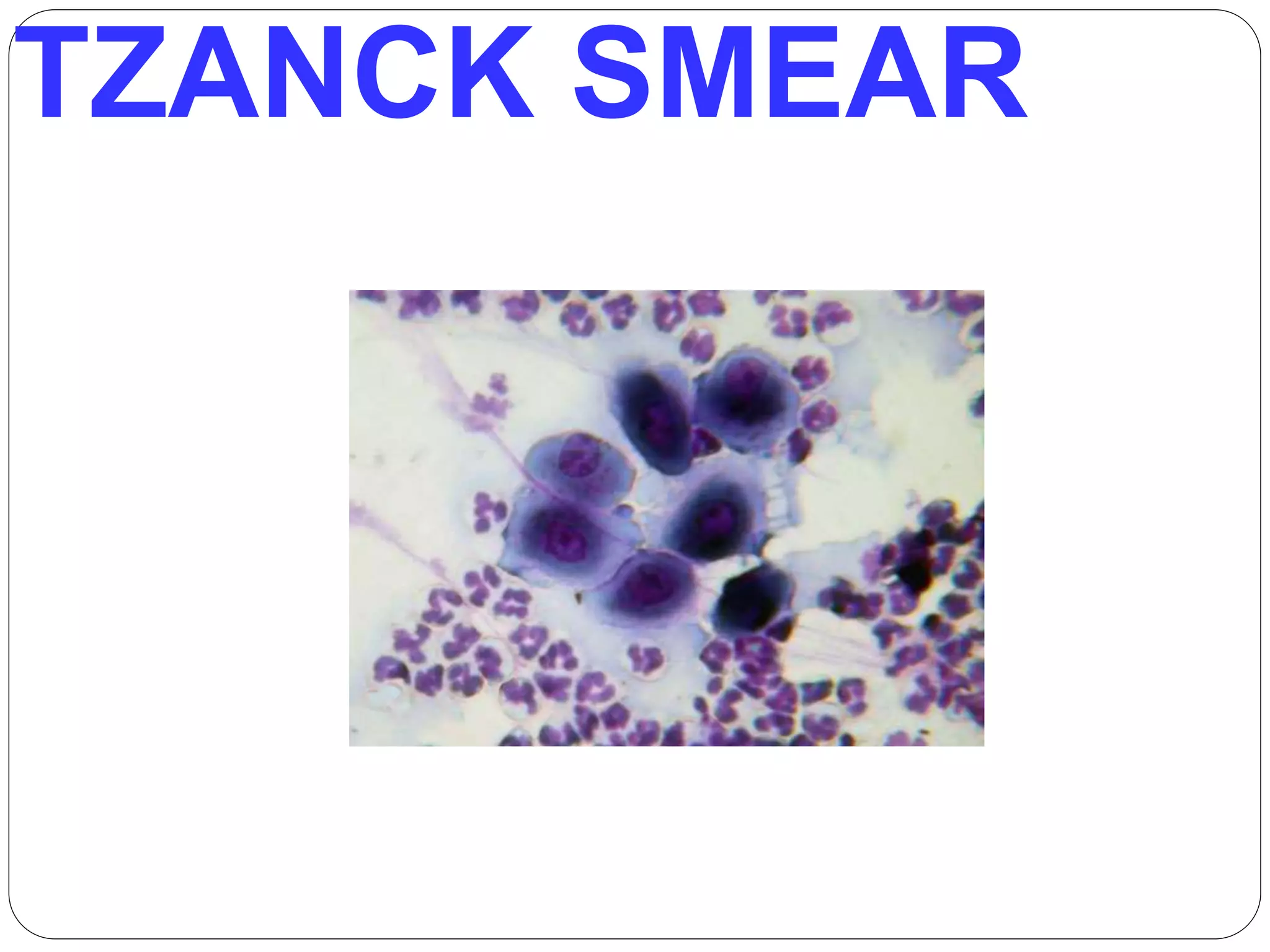 Lesions of oral cavity and salivary gland. | PPTX