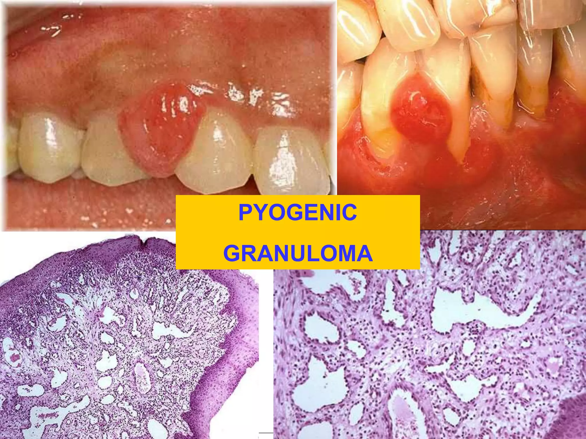 Lesions of oral cavity and salivary gland. | PPTX