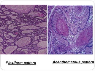 Lesions of oral cavity and salivary gland. | PPTX