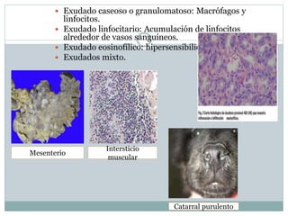 Inflamación aguda | PPT
