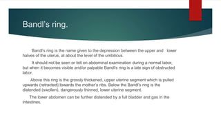 OBSTRUCTED LABOR | PPTX