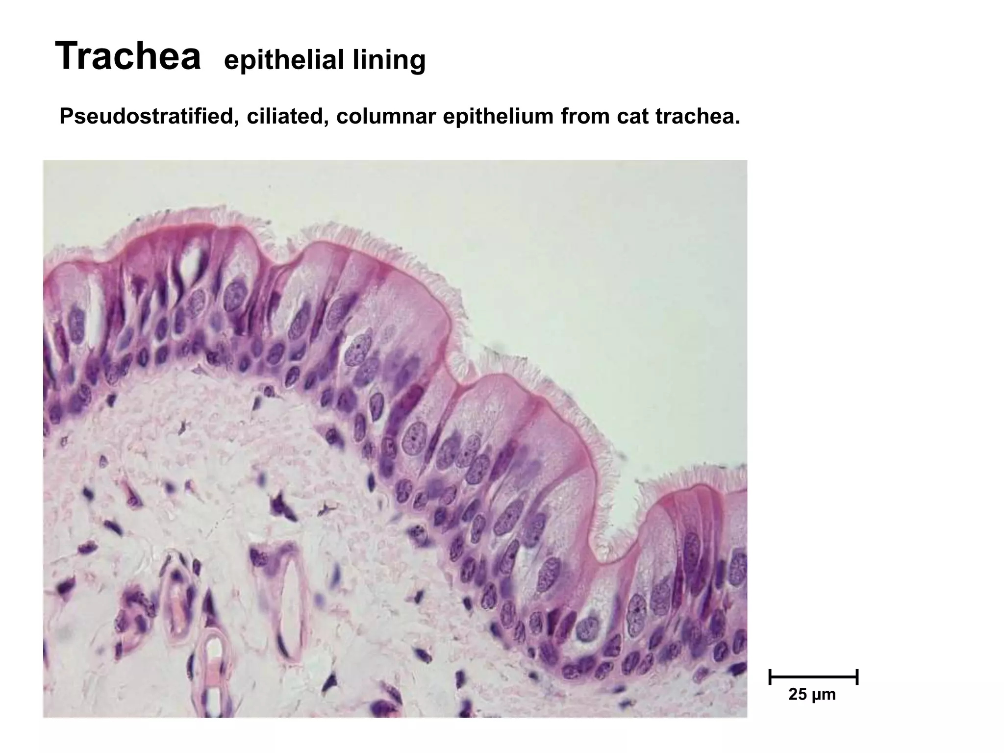 Histology of the Respiratory System | PPTX