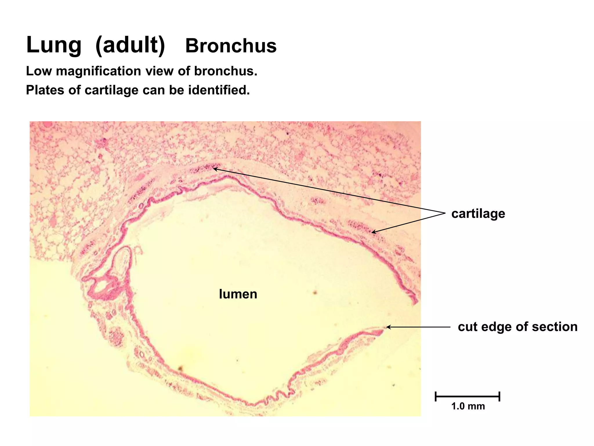 Histology of the Respiratory System | PPTX