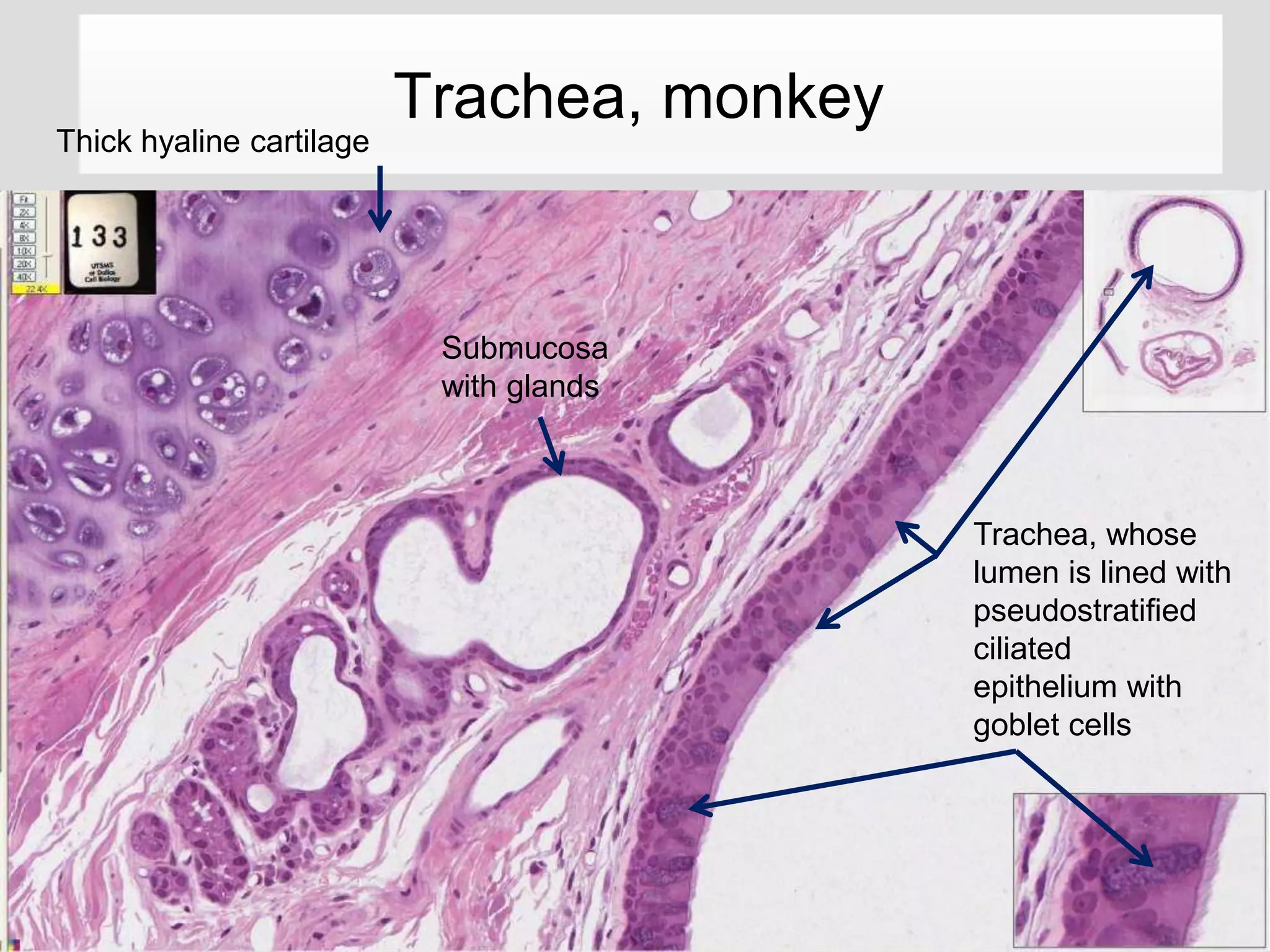 Histology of the Respiratory System